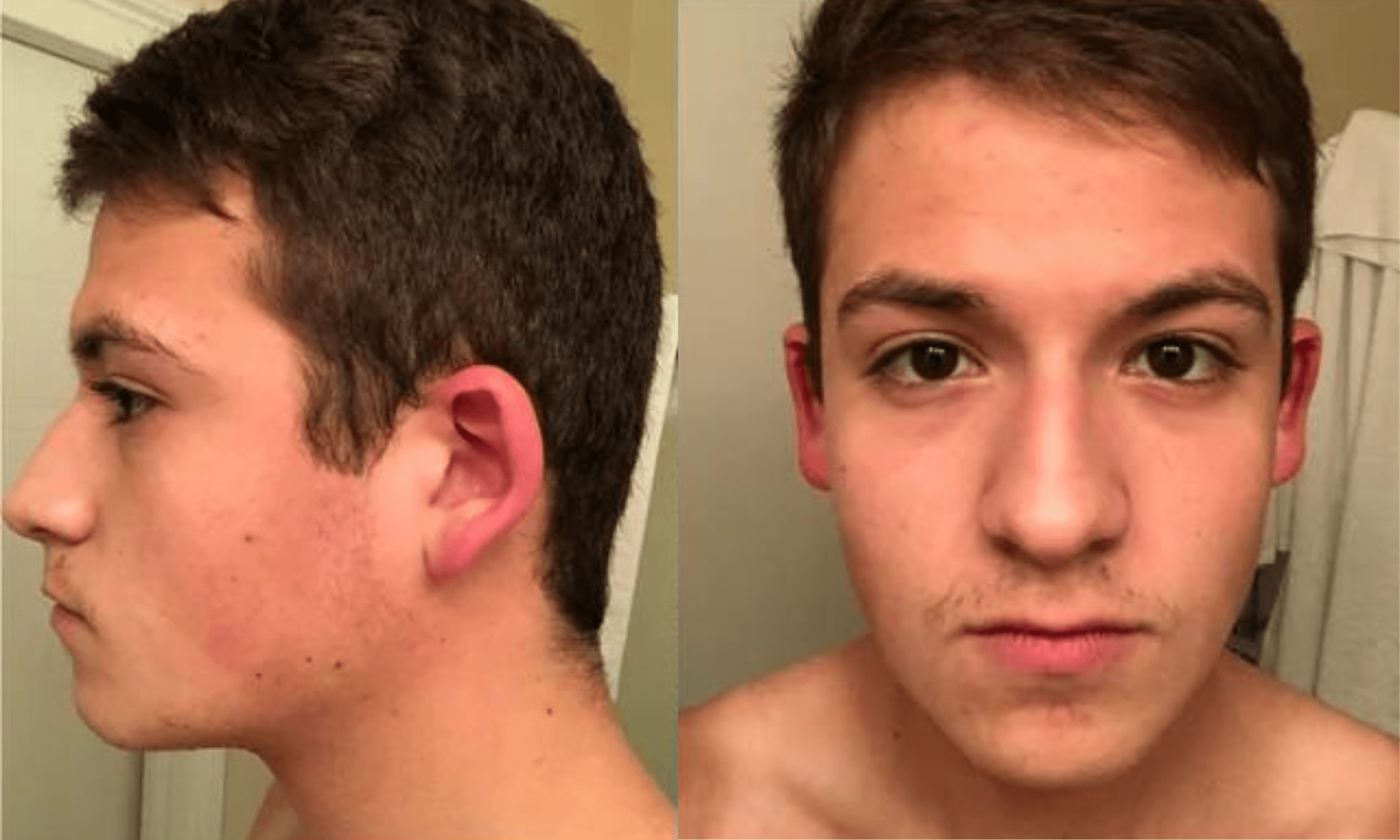 OXYFIT™ Cardio Breath Trainer : Elevate Endurance & Lung Capacity